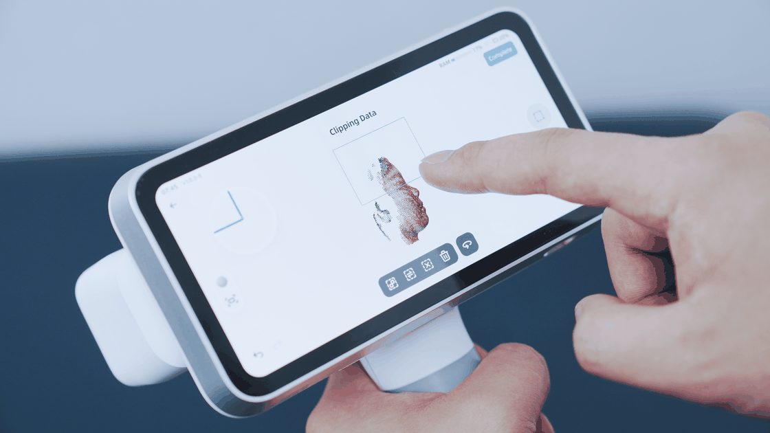 SHINING 3D Launches All-in-One Wireless 3D Scanner for Orthotics ...