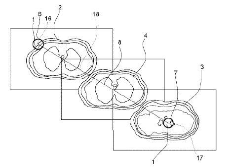 Verfahren und Computerprogramm zur Visualisierung von Tomografiedaten