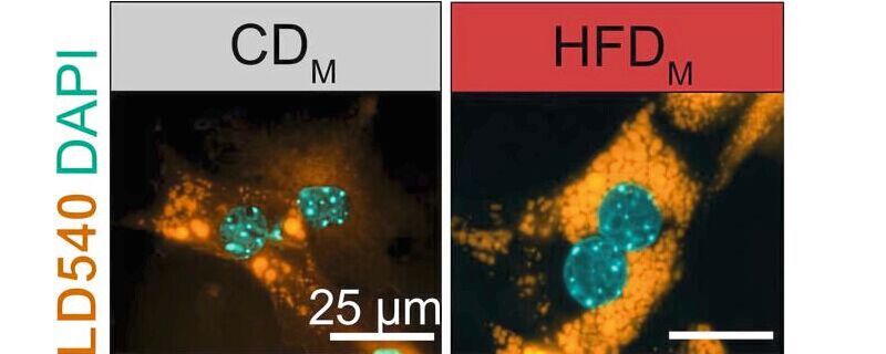Einfluss der Mütterlichen Gesundheit auf die Leberentwicklung des Kindes