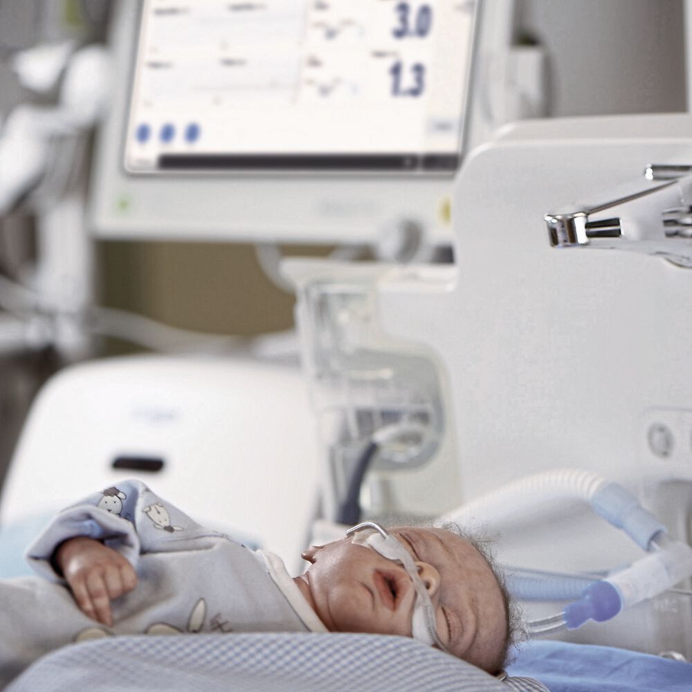 Software schützt die Lunge während der Beatmung