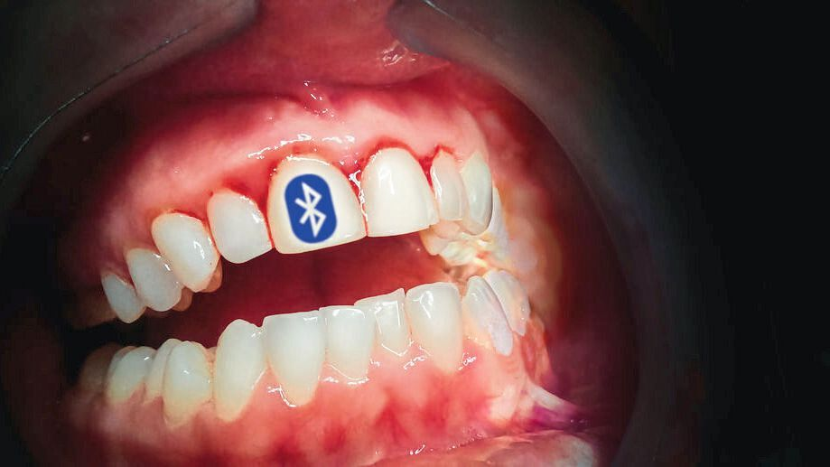 BleedingTooth: Sicherheitslücke in Bluetooth unter Linux entdeckt