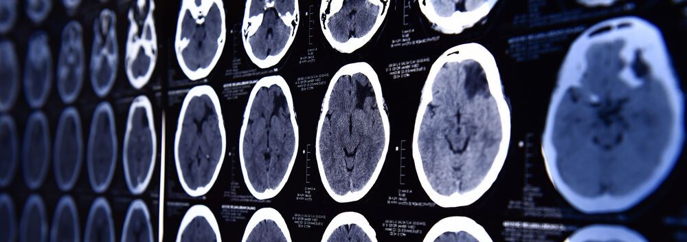 Strahlenfreie Technologie macht Diagnose am Menschen möglich | MPI