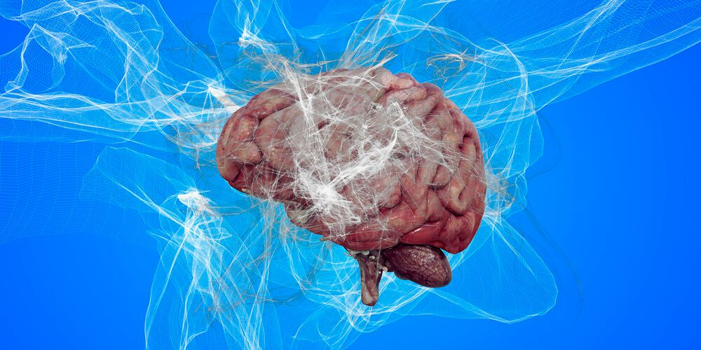 Jung und dement? KI erkennt seltene Demenz-Erkrankungen