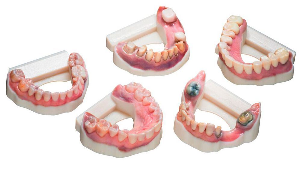 Stratasys und 3-Shape künden automatisierte Farbgestaltung beim 3D-Druck an