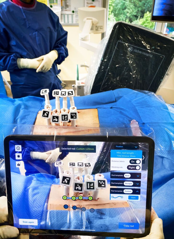 AR-Einsatz in der Wirbelsäulenchirurgie