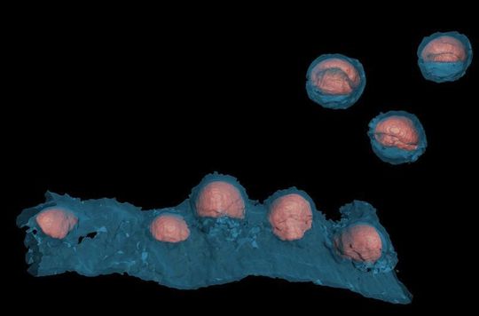 Freisetzung von HIV aus der Wirtszelle