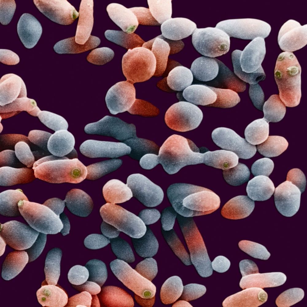 Proteinaggregate verhelfen Hefezellen zu einem Gedächtnis