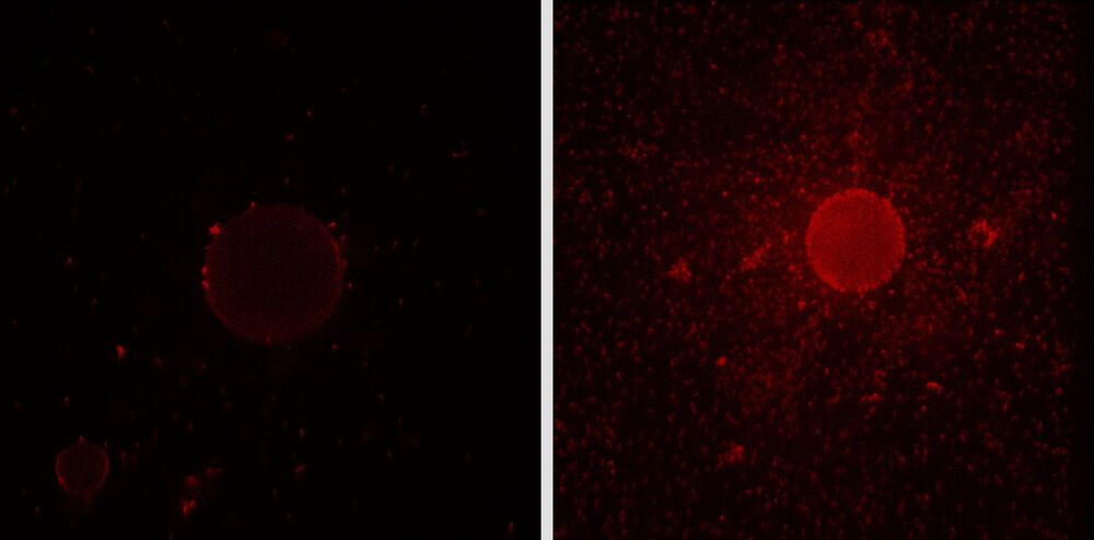 Wie ein Bakterium mit „Bio-Spüli“ Öl verdaut