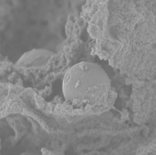 New Therapy Can Prevent Allergic Reactions